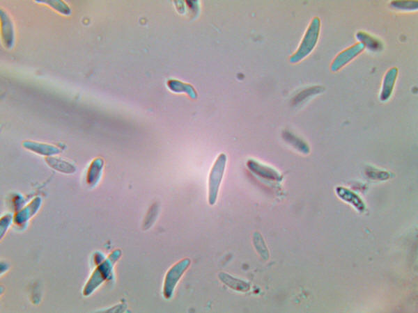 Calycina_conorum