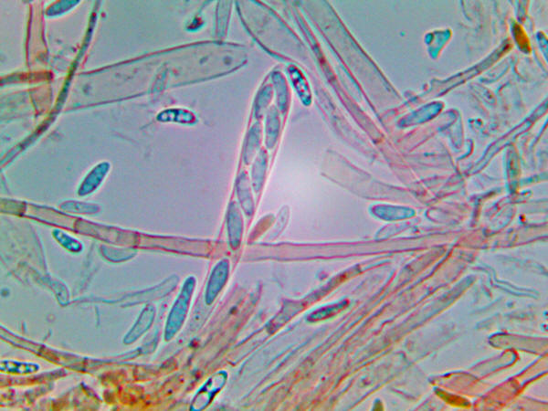 Calycina_conorum