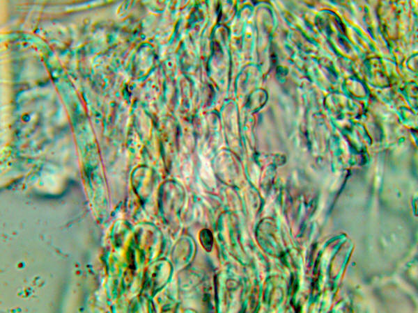 Calycina_conorum